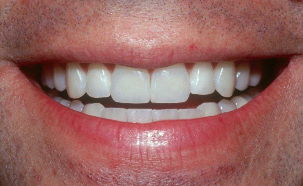 Montgomery Dental Care | Woodbury Cosmetic & Family Dentistry