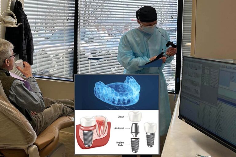 Advanced Dental Implant Technology | Montgomery Dental Care